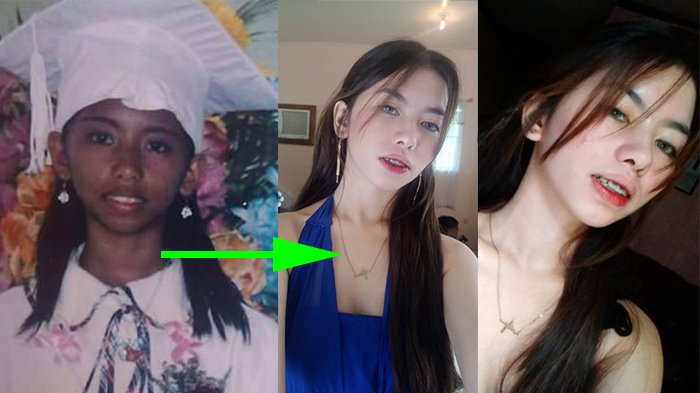 Viral Foto Cewek Dulu Berkulit Gelap, Kini Penampilannya Berubah ...