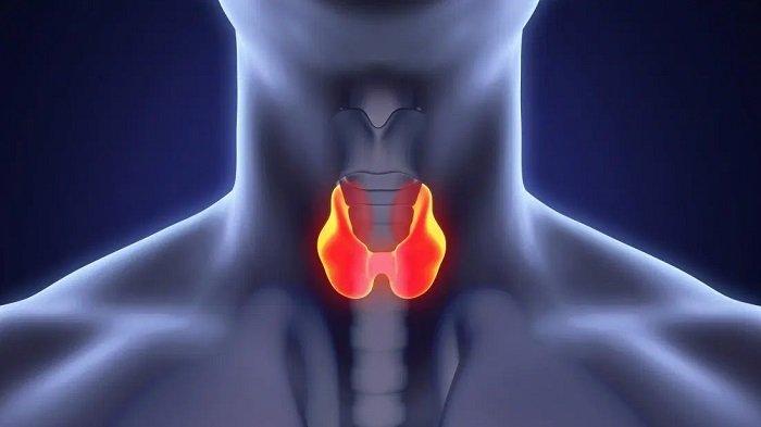 Tumor Tiroid - Kenali Penyebab, Gejala, Pengobatan hingga Pencegahan ...