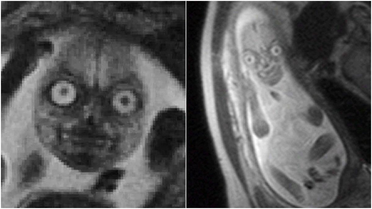 MERINDING! Viral Hasil Foto MRI Bayi yang Belum Lahir, Malah Bikin ...