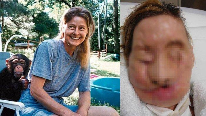 DIKIRA MALING, Wanita Ini Diserang Simpanse, Nahas Wajah Cantiknya ...