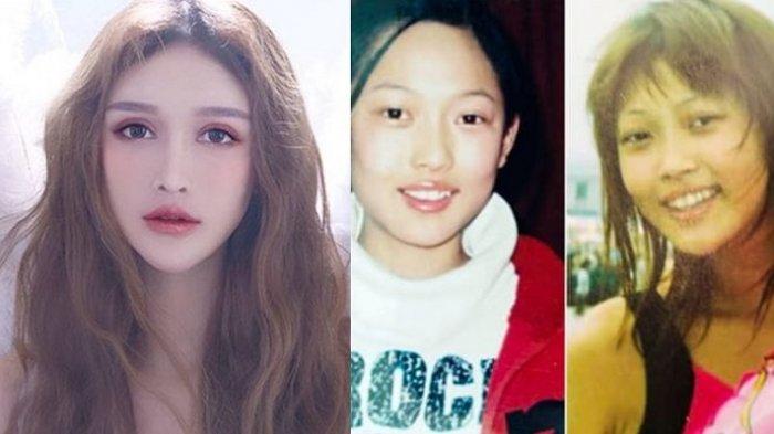 Jadi Cantik Setelah 100 Kali Operasi Plastik Senilai Rp 8 Miliar, Lihat ...