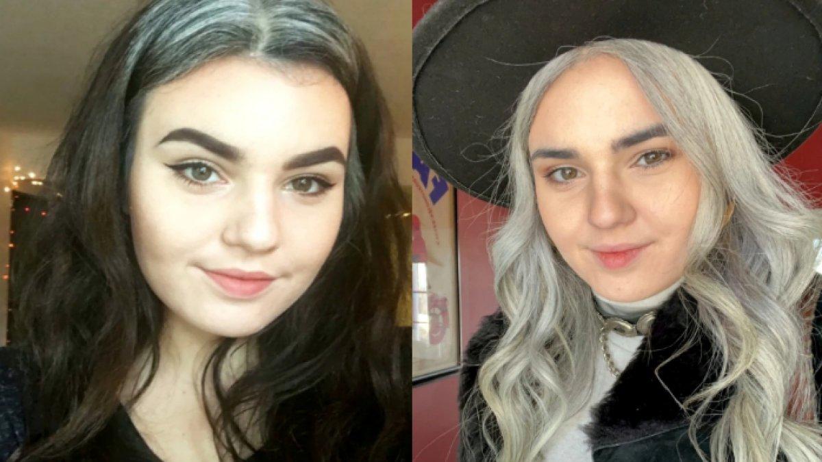 Sudah Berubah sejak 12 Tahun, Rambut Memutih Semua di Usia 25, Dulu ...