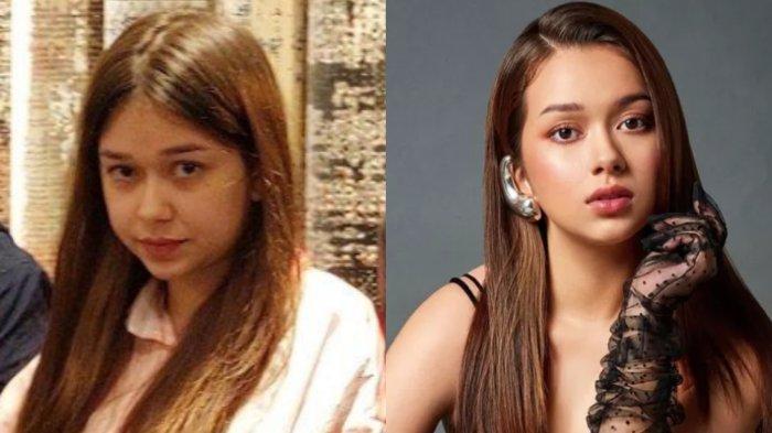 Imbas Kasus Video Viral, Rebecca Klopper Trauma hingga Jalani Pemulihan Dapat Support Keluarga ...