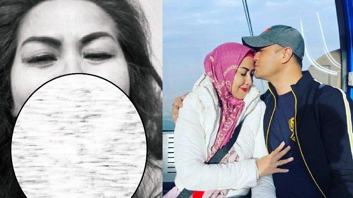 Kronologi Ferry Irawan Diduga KDRT Venna Melinda Sampai Berdarah dan Teriak Histeris: Saya ...