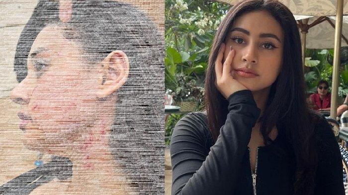 Kronologi Afifah Riyad Dipukuli Mantan Pacar Suami, Viral Gegara Speak ...