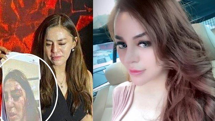 Kisah Selebgram Safa Marwah Dianiaya Pacar Profesi ASN Gegara Tagih Utang Rp 42 Juta, Kronologi ...