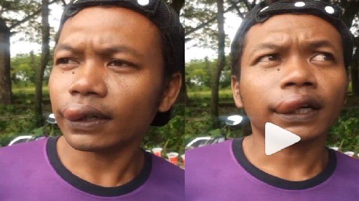 Video Viral Pria Disengat Tawon, Tunjukkan Perubahan Bibir Sebelum ...