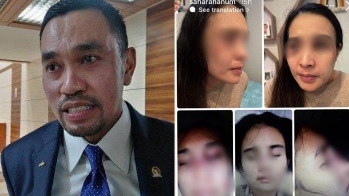 Kasus Putri Balqis Korban KDRT Jadi Tersangka, Ahmad Sahroni Senggol Kapolri Jenderal Listyo ...