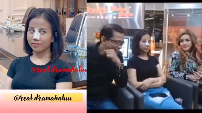 Heboh Mayang Adik Vanessa Angel Operasi Hidung, Rela Habiskan 50 Juta ...
