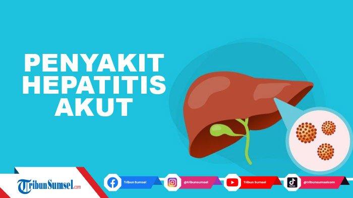 Hepatitis Akut Adalah? Ini Penjelasan Lengkapnya, Penyebab, Gejala, dan ...
