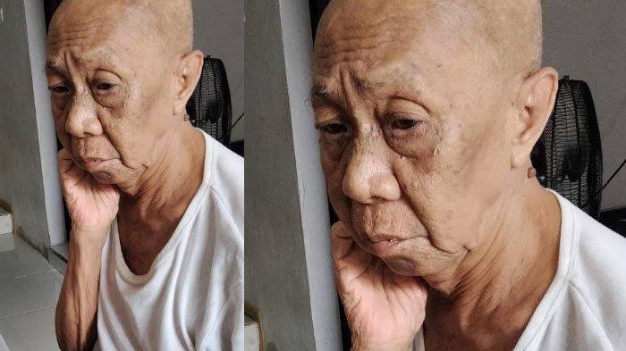 UPDATE Kondisi Abdul Hamid 'Pak Ogah', Mulai Membaik Namun Semakin ...