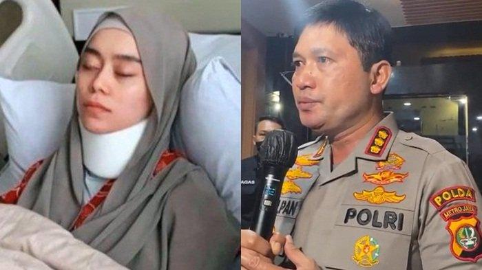 Kondisi Lesti Kejora Usai Keluar RS Tak Ingin Tinggal Bareng Rizky Billar, Trauma dan Ketakutan ...