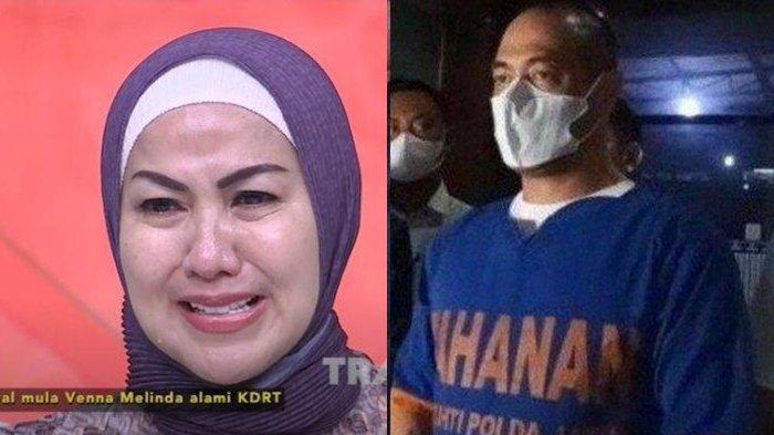 Kondisi Miris Venna Melinda Usai Alami KDRT, Tidur Cuma 2 Jam Hingga Ingin Diterapi Hilangkan ...