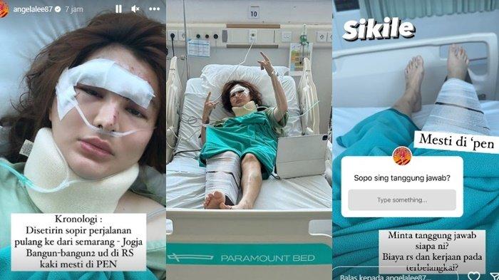 Kronologi Angela Lee Kecelakaan Mobil di Perjalanan Semarang ke Jogja ...