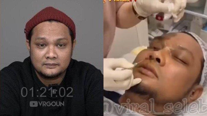Virgoun Permak Hidung Jelang Sidang Cerai dengan Inara Rusli ...