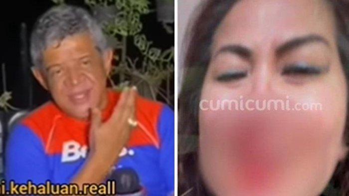 Pakar Telematika Abimanyu Bongkar Keanehan Foto Venna Melinda Berlumuran Darah di KDRT Ferry ...