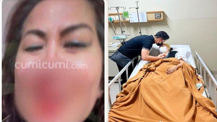 Pengakuan Venna Melinda di KDRT Ferry Irawan, Hidung Berdarah Dapat Perlakuan Ini, Saksi Staff ...