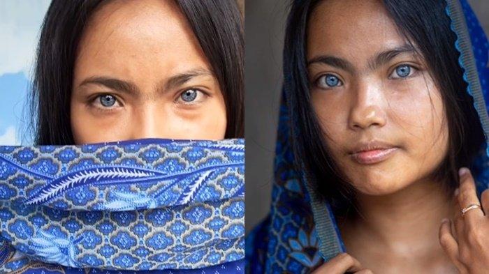 Sosok Evi Gadis Jawa Barat Bermata Indah Warna Biru Didatangi ...