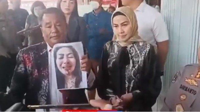 Tangis Venna Melinda, Mantap Ceraikan Ferry Irawan Setelah 3 Bulan di KDRT: Aku Gak Sanggup Lagi ...