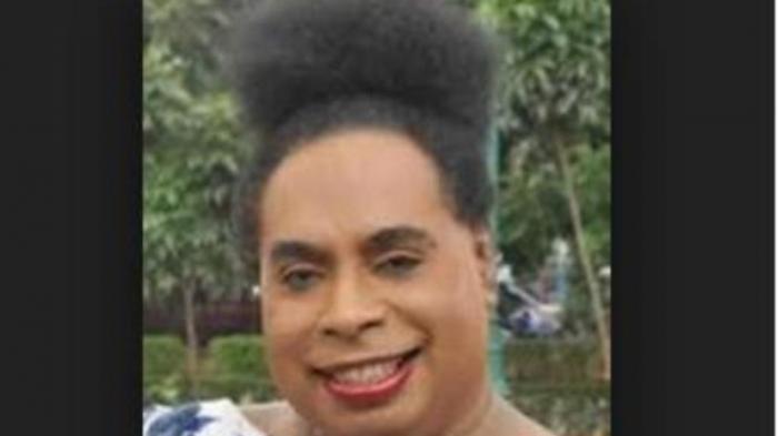 Ternyata Ade Juwita Mengidap Kelenjar Getah Bening - Tribunsumsel.com