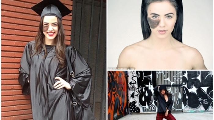 Dibilang Jelek, Model Cantik Ini Tak Mau Hilangkan Tanda Lahir di ...