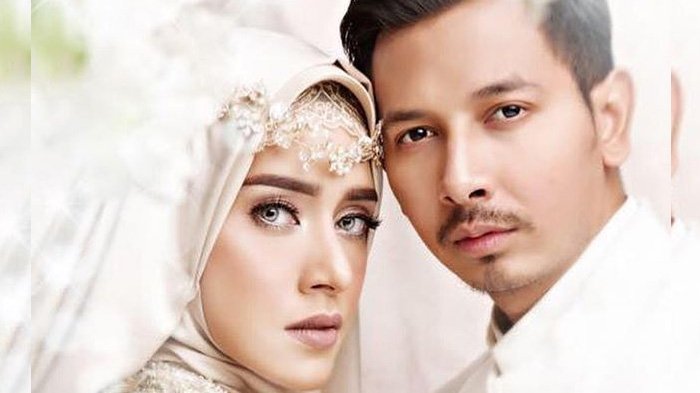 Kondisi Terkini Sonny Septian Setelah Divonis Dokter Alami Penyumbatan ...