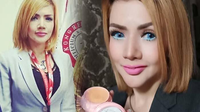 Isi ATM Barbie Kumalasari yang Miliaran Kini Tinggal Jutaan Rupiah, Istri Galih Beberkan ...