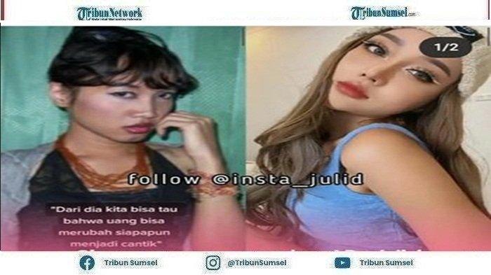 Transformasi Wajah Wajah Lucinta Luna Sebelum & Sesudah Operasi Plastik ...