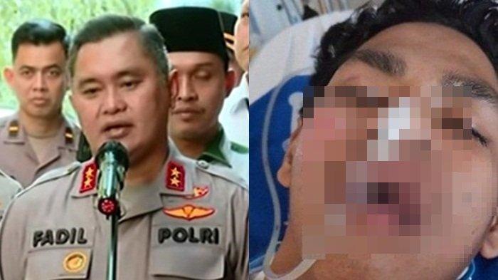 Kapolda Metro Jaya Turun Tangan Kasus Penganiayaan David oleh Mario Dandy: Selesaikan Seadil ...