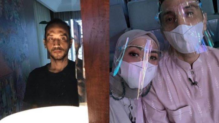 Istri Pantau Setiap Menit, Gary Iskak Sempat Menyerah Penyakit ...