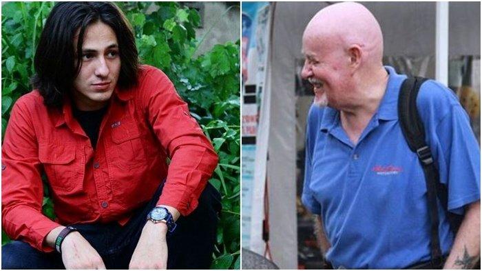 Dylan Carr Sukses Lakukan Operasi Pergantian Tulang, Begini Kondisi ...