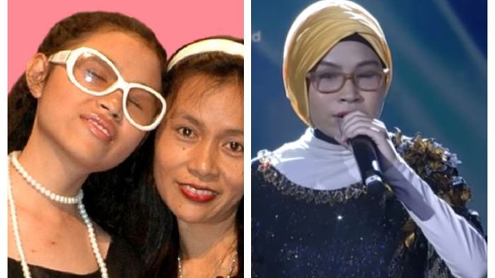 Masih Ingat Sosok Fiersha Juara 3 di Ajang Mamamia? Begini Kondisinya Sekarang,Bikin Pangling ...