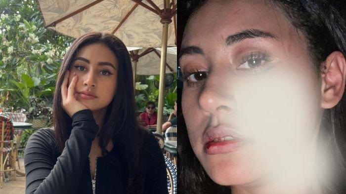 Biodata Afifah Riyad Selebgram yang Mengaku Dianiaya Mantan Pacar Suami ...