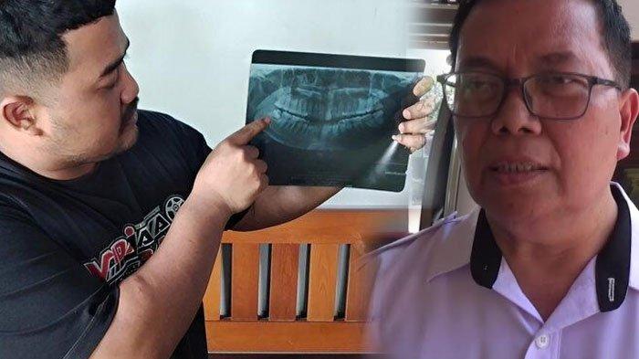 Nasib Dokter Gigi SW yang Cabut Gigi Bungsu Wanita Ngawi hingga ...