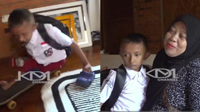 Ayah Meninggal Dunia, Ibu Dimputasi, Kisah Ikbal Bocah Disabilitas Kelas 1 SD Menyentuh Dedi ...