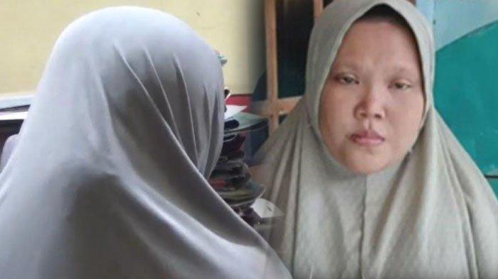 Pengakuan Terbaru Saksi Kasus Kepala Bayi Tertinggal di Rahim, Bibi ...