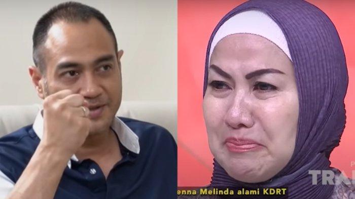 KONDISI Luka Venna Melinda Terungkap Usai Jalani Penyembuhan Tahap Awal, Psikolog: Dia Orang ...