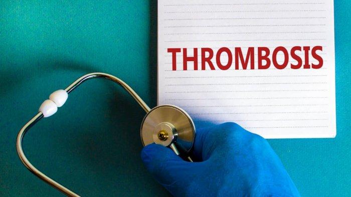 5 Cara Menjaga Angka Normal Trombosit, Asupan Tubuh Sangat Diperhatikan ...