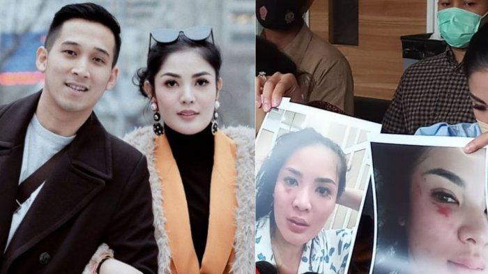 Biodata Askara Parasady Harsono yang Dituduh KDRT hingga Selingkuh oleh ...