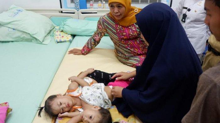 Bayi Kembar Siam Asal Kendari Masih Jalani Pemeriksaan Lanjutan di RSUD Dr Soetomo - Surya.co.id