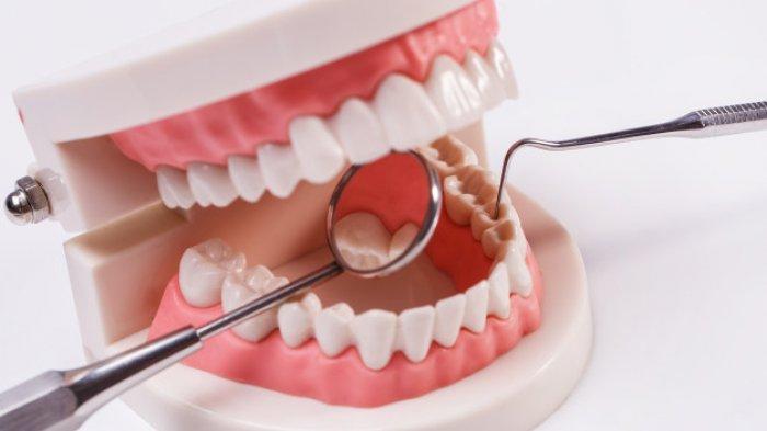 LIFEPACK: Gigi Busuk Akibat Diabetes, Berikut 6 Gejala dan Cara ...