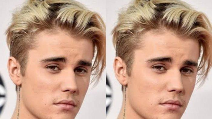 Justin Bieber Divonis Idap Lyme Disease, Berikut Penyebab dan Beberapa ...