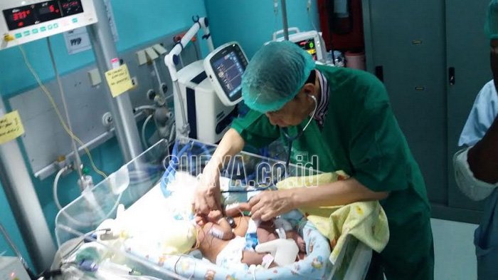 Bayi Kembar Siam Asal Lamongan Dirawat di RSUD dr Soetomo Surabaya, Begini Kondisinya Saat Ini ...