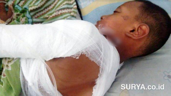 Main Petasan Spiritus Rakitan, Seorang Bocah di Jombang Terbakar ...