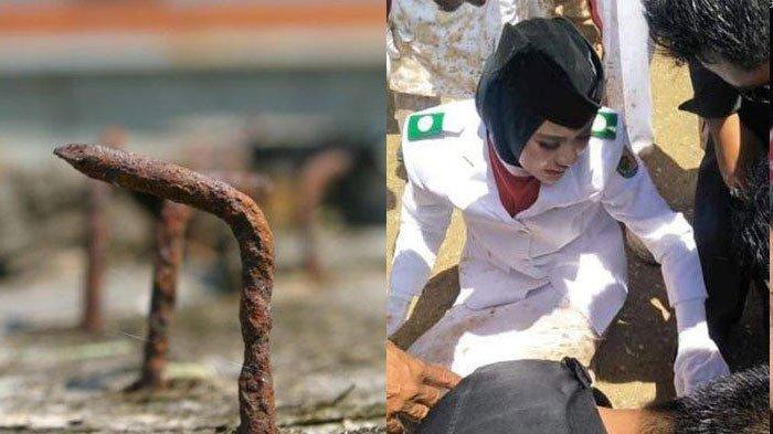 Paskibraka yang Tertusuk Paku Bersyukur Lukanya Tak Infeksi Tetanus ...