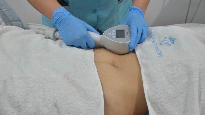 Ingin Punya Lingkar Perut Ideal Tanpa Pembedahan, Pakailah Solusi ...