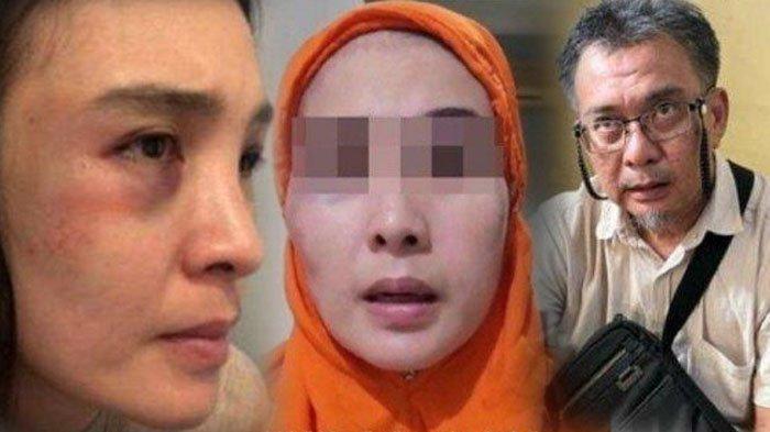 NASIB Putri Balqis Istri Korban KDRT Suami setelah Lepas Tahanan, Ngotot Cerai, Ini Update ...