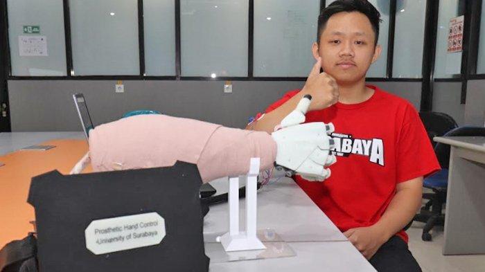 Mahasiswa Ubaya Terapkan Sistem Artificial Intelligence pada Tangan ...