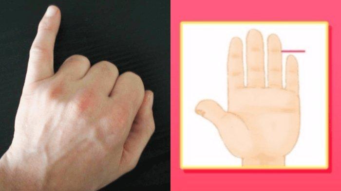Tes Kepribadian - 3 Tipe Jari Kelingking ini Ungkap Sifat Aslimu, Cukup ...