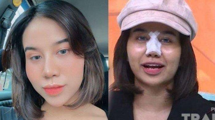 Aksi Mayang Tak Kapok Operasi Plastik demi Glow Up Jadi Sorotan, Kini Pengen Hidung Makin Lancip ...